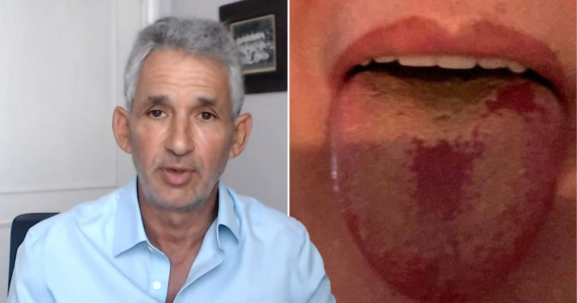 GJITHNJË E MË SHUMË TË INFEKTUAR ME KORONAVIRUS SHFAQEN ME KËTË ... GJITHNJË E MË SHUMË TË INFEKTUAR ME KORONAVIRUS SHFAQEN ME KËTË ...