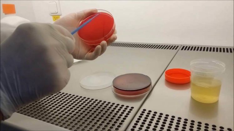 Што е уринокултура? - Panacea.mk